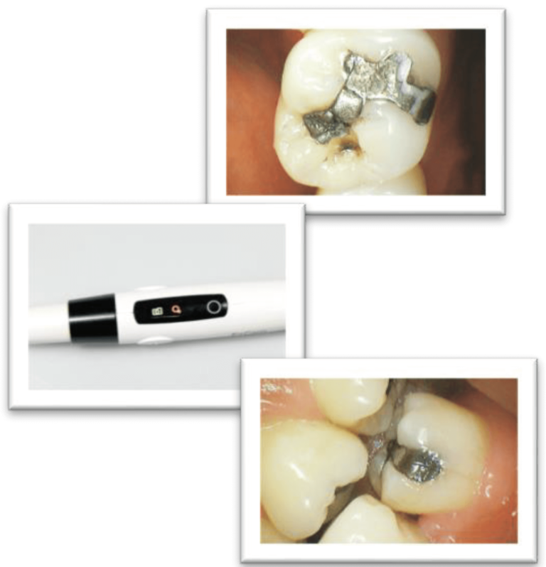 EzCam - Vatech Mexico